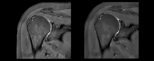 Dr. Alfreda Johnson Webb: A Woman of Many Firsts in Science – Her Stem ...